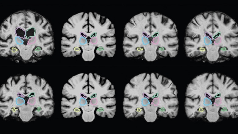Algorithm Enables Faster Analysis Of Medical Images Tech Briefs