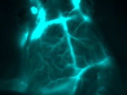 New Deep-Tissue Imaging Technique Illuminates Hidden Tumors - Tech Briefs