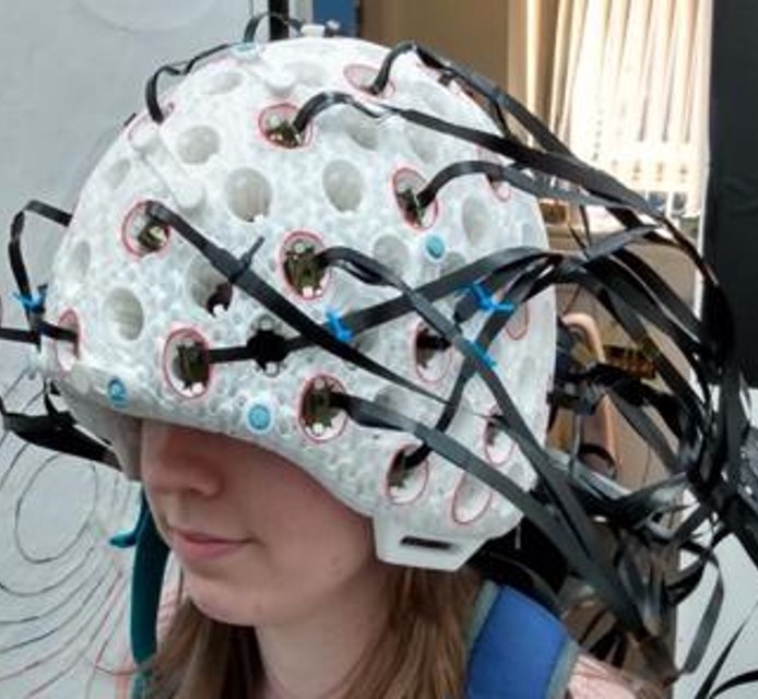 Brain Scanner Technology Expanded for Whole Head Imaging - Tech Briefs
